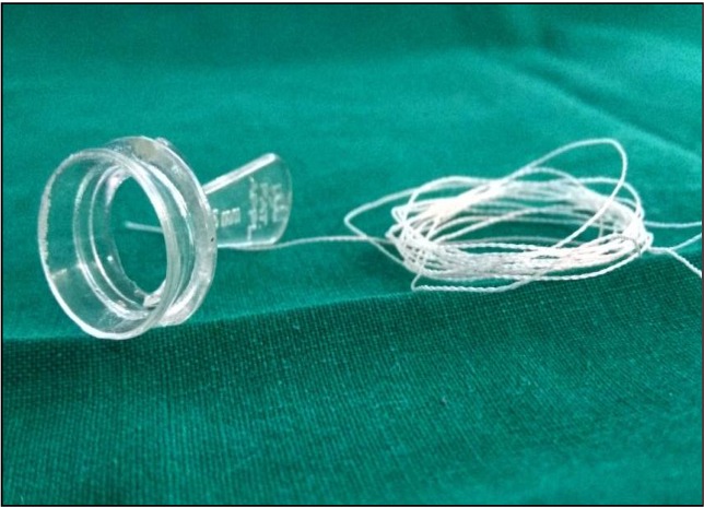 What is the plastibell procedure? - Circumcision Clinic